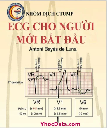 ECG Tài Liệu – YHocData