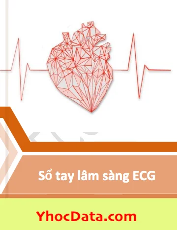 ECG – YHocData