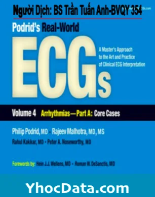 ECG Tài Liệu – YHocData