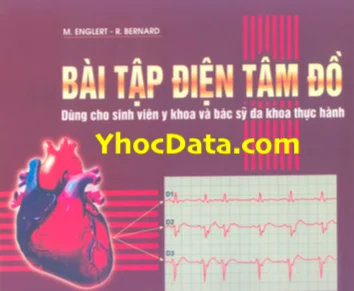ECG – YHocData