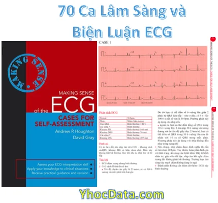 ECG – YHocData